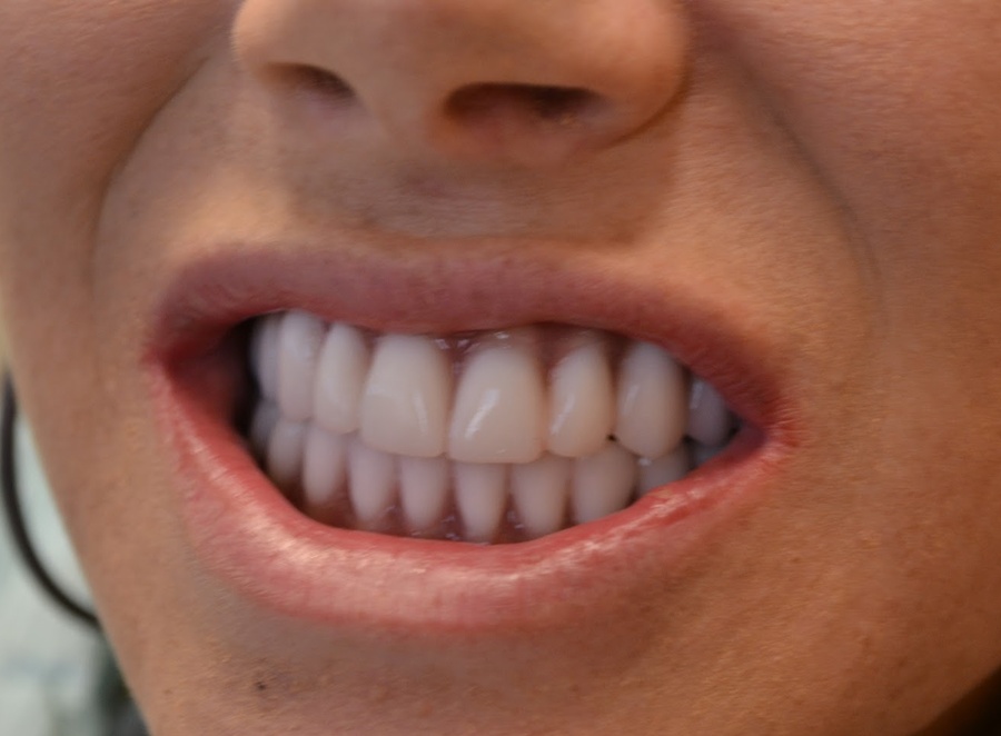 Andes on line | Programa dental Sonríe con Alegría se lanzó como idea ...